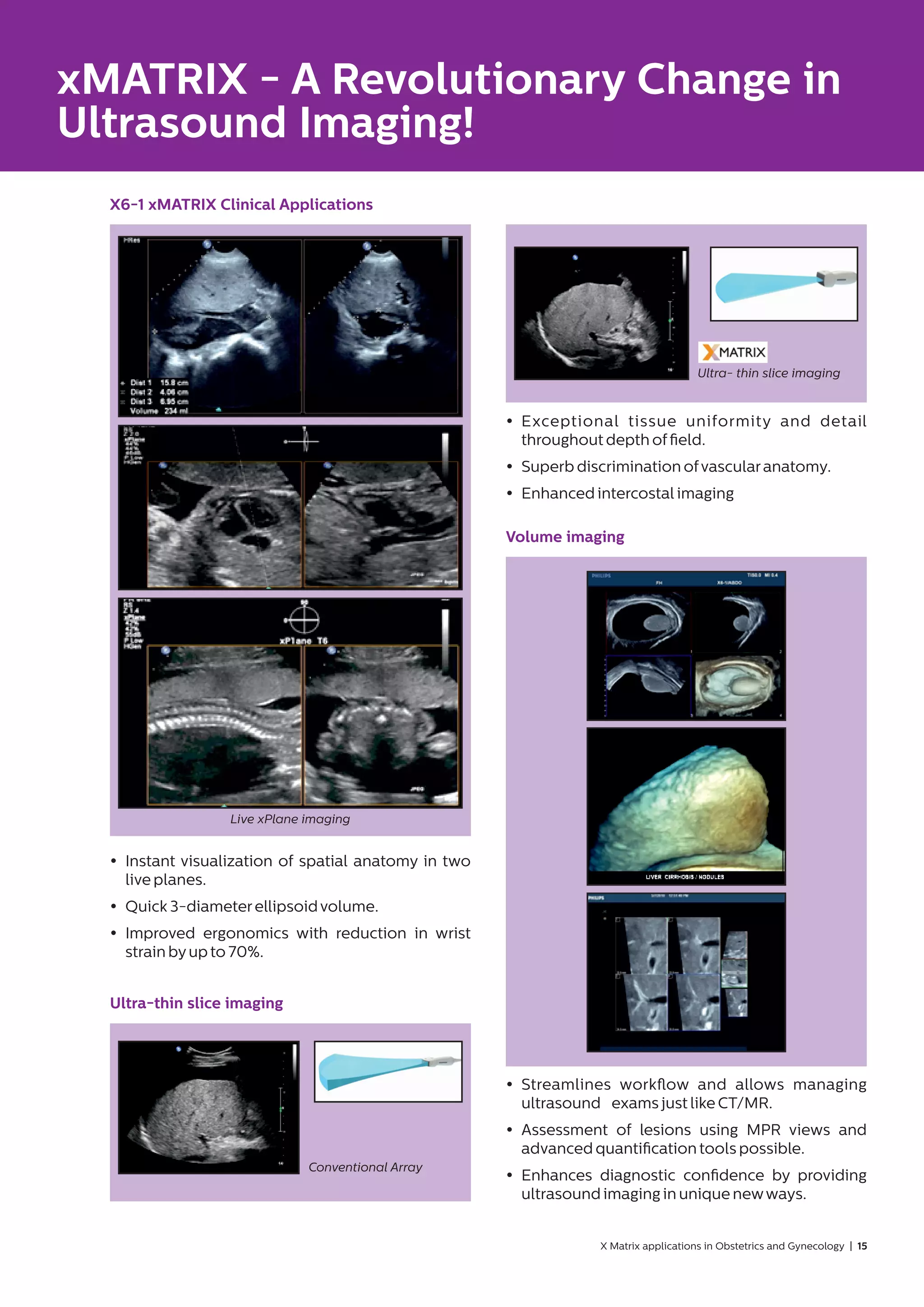 Brochure x matrix new | PDF