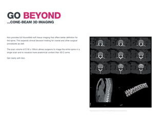 Airo Mobile Intraoperative CT Brochure | PDF