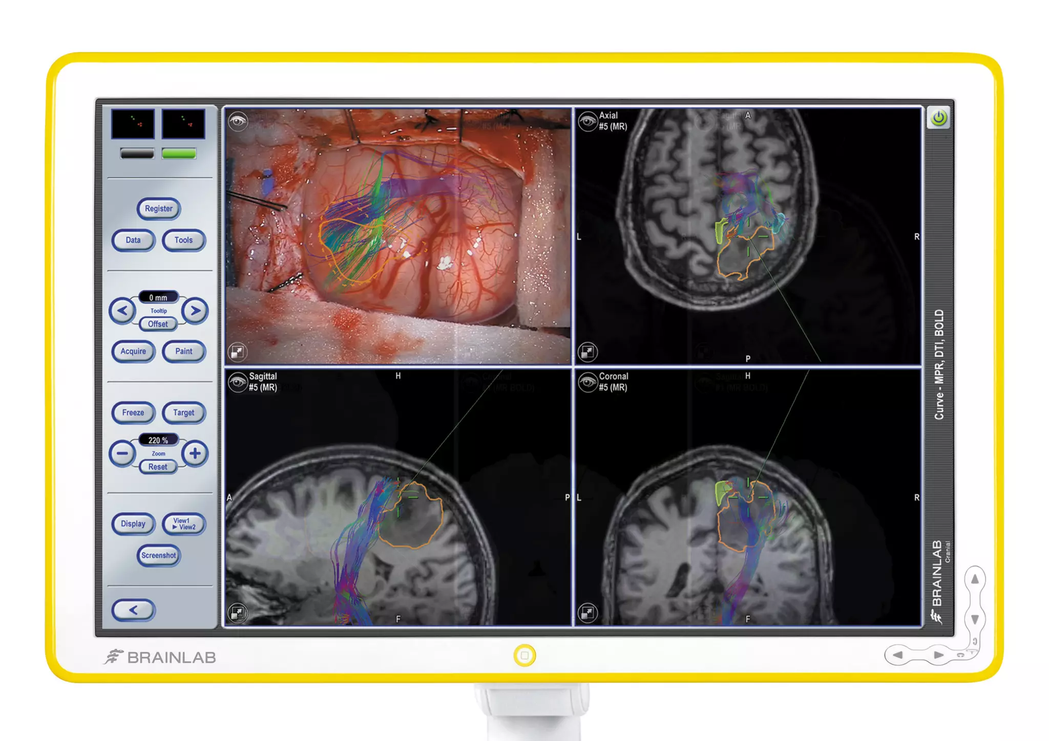 Curve Image Guided Surgery Brochure | PDF