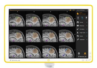 Curve Image Guided Surgery Brochure | PDF