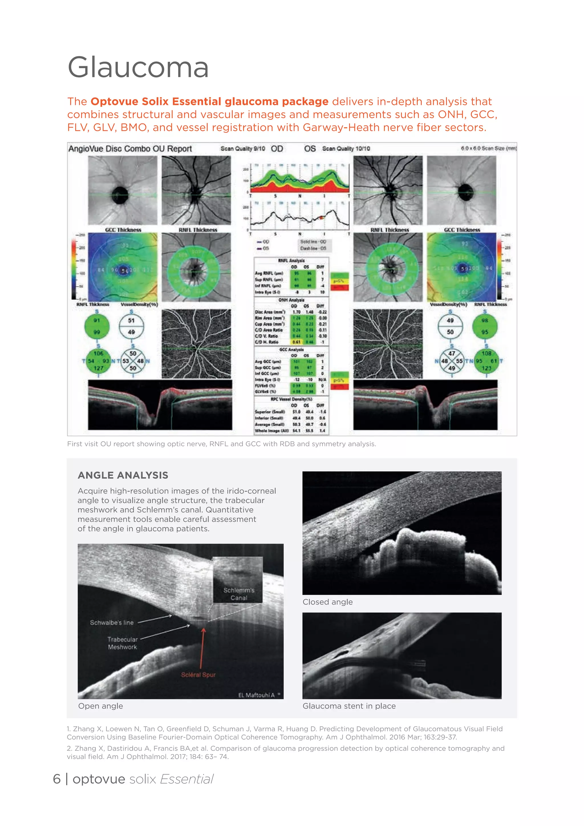 SOLIX Essential Brochure | PDF