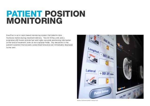 ExacTrac Image-Guided Radiotherapy Brochure