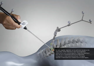 Image-Guided Spine Navigation Brochure | PDF