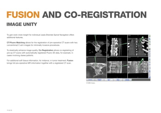 Image-Guided Spine Navigation Brochure | PDF