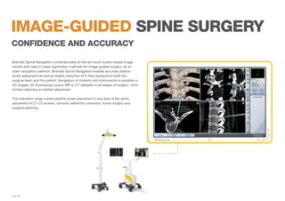 Image-Guided Spine Navigation Brochure | PPT