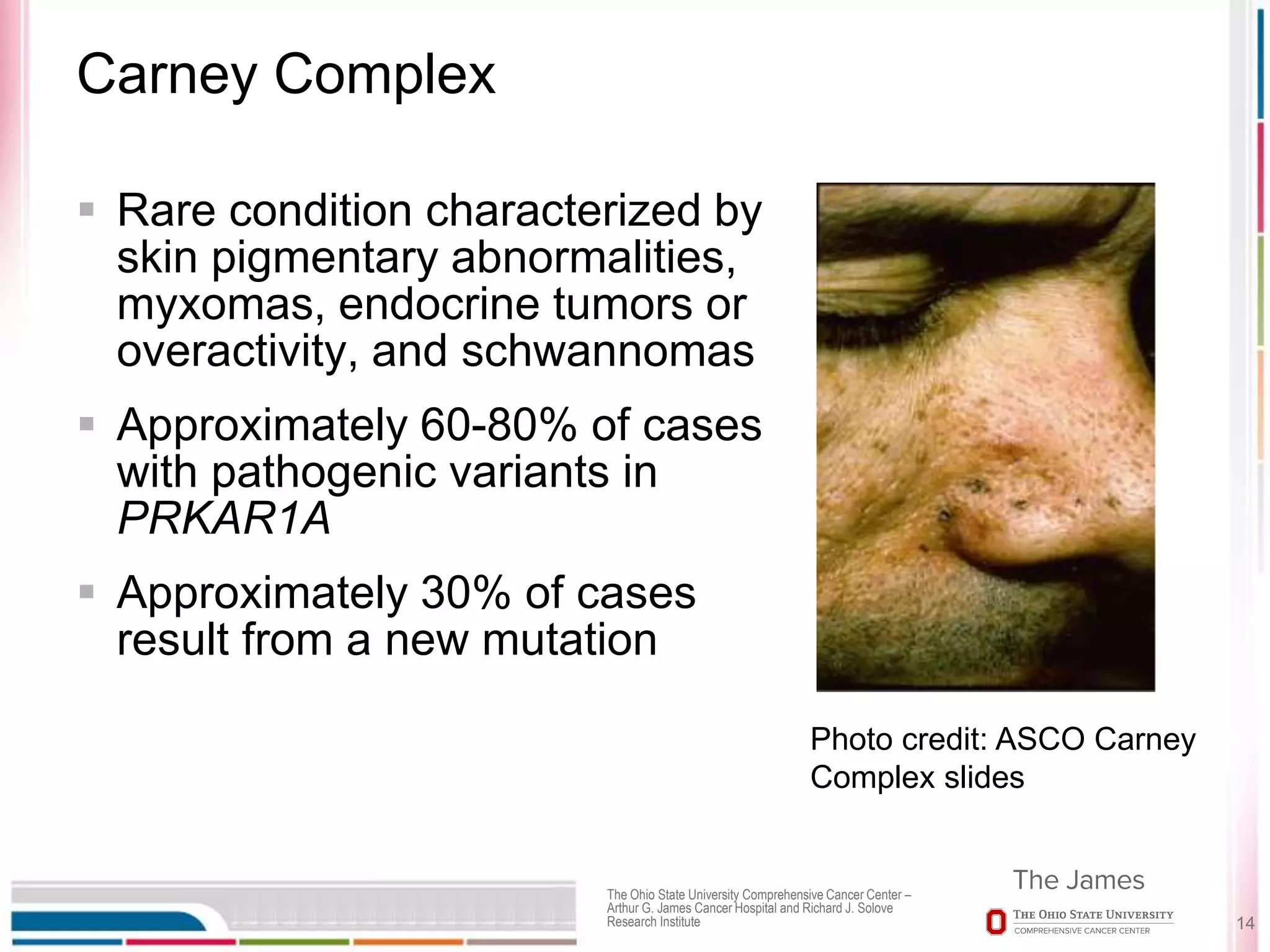 Genetic Syndromes and Thyroid Cancer by Pamela Brock, MS, LGC | PPTX