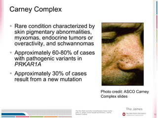 Genetic Syndromes and Thyroid Cancer by Pamela Brock, MS, LGC | PPTX