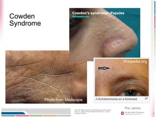 Genetic Syndromes and Thyroid Cancer by Pamela Brock, MS, LGC | PPTX