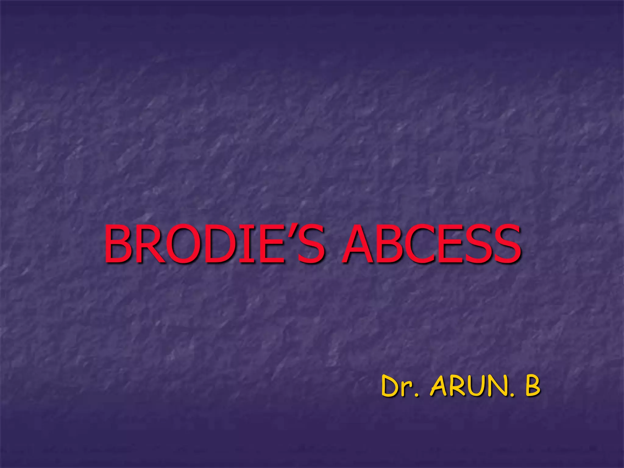 Brodie's abcess | PPT