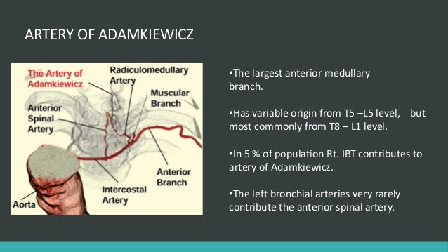 Artery Of Adamkiewicz Angiogram