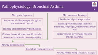 Bronchial asthma | PPTX