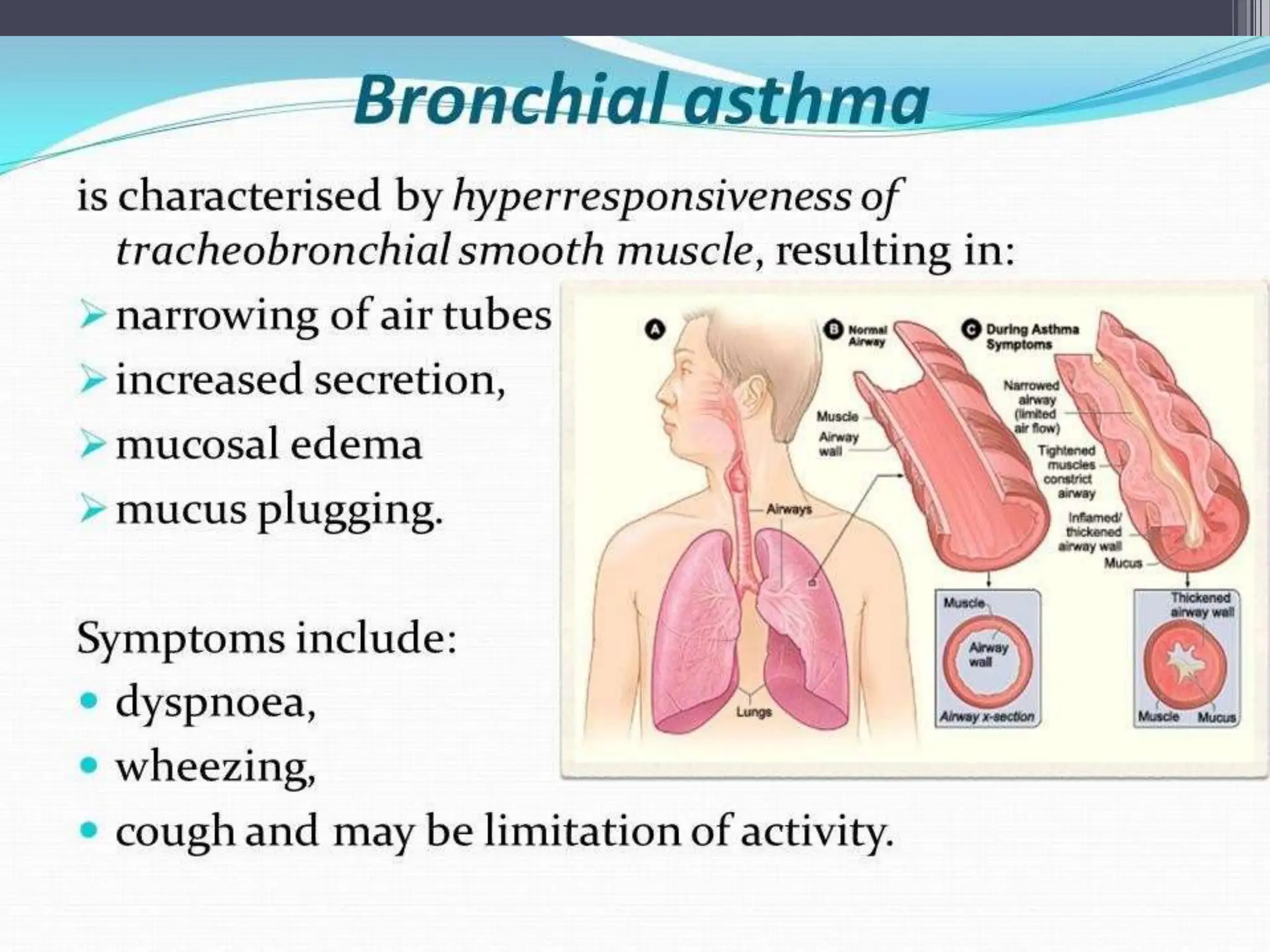 Airways obstruction (Bronchial Asthma).pptx
