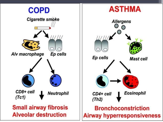 Airways obstruction (Bronchial Asthma).pptx