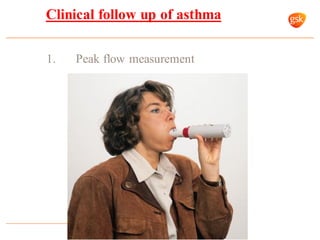 Bronchial Asthma and Asthma Control | PDF