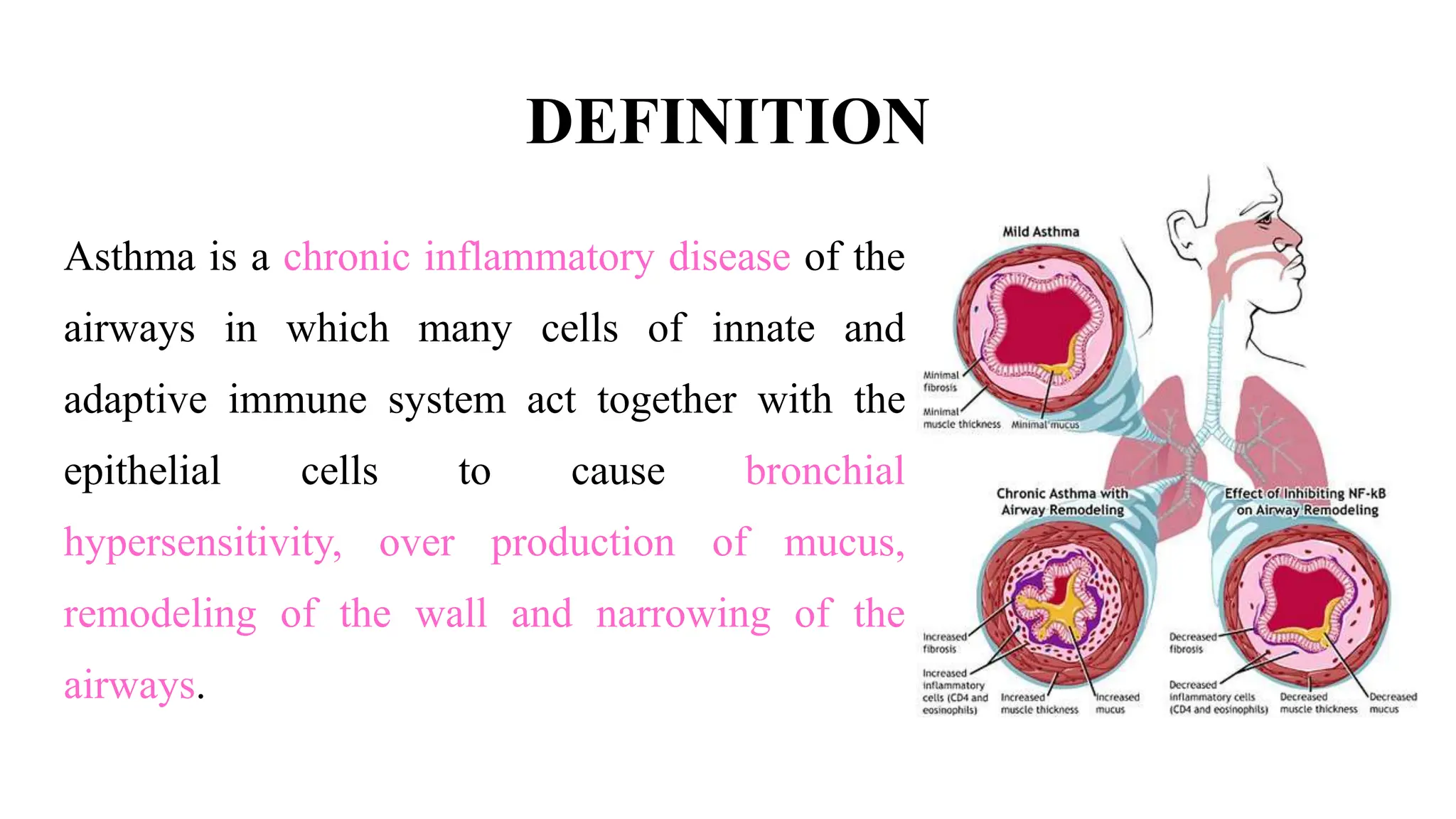 PEDIATRIC BRONCHIAL ASTHMA- journal presentation | PPTX