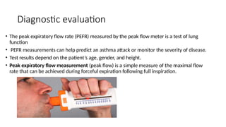Bronchial Asthma new ppt04.pptx including | PPTX