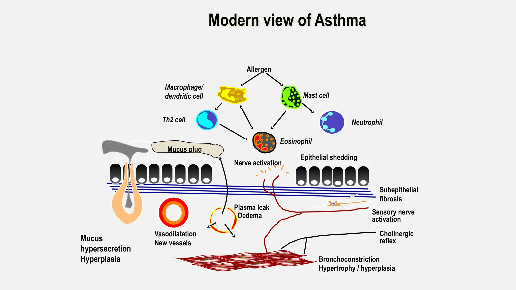 Bronchial Asthma in children.Approach to asthma | PPTX