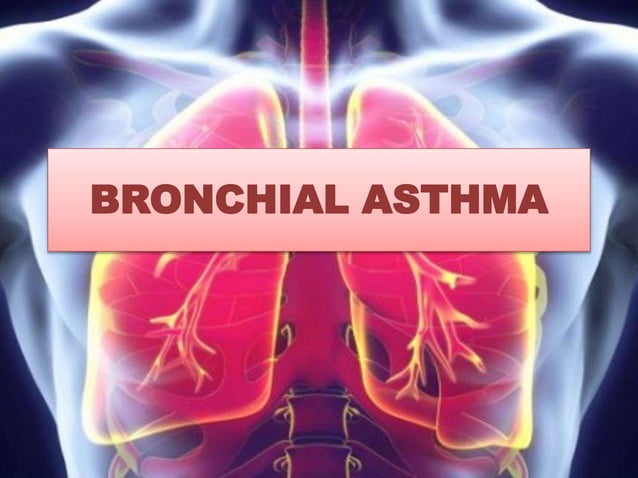 Bronchial asthma tutorial | PPT