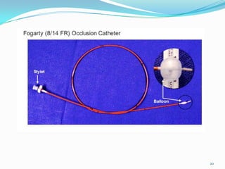 Bronchial blockers & endobronchial tubes | PPTX