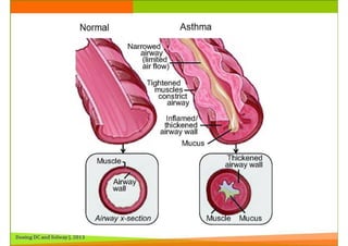 Bronchial provocation test in clinical practice | PDF