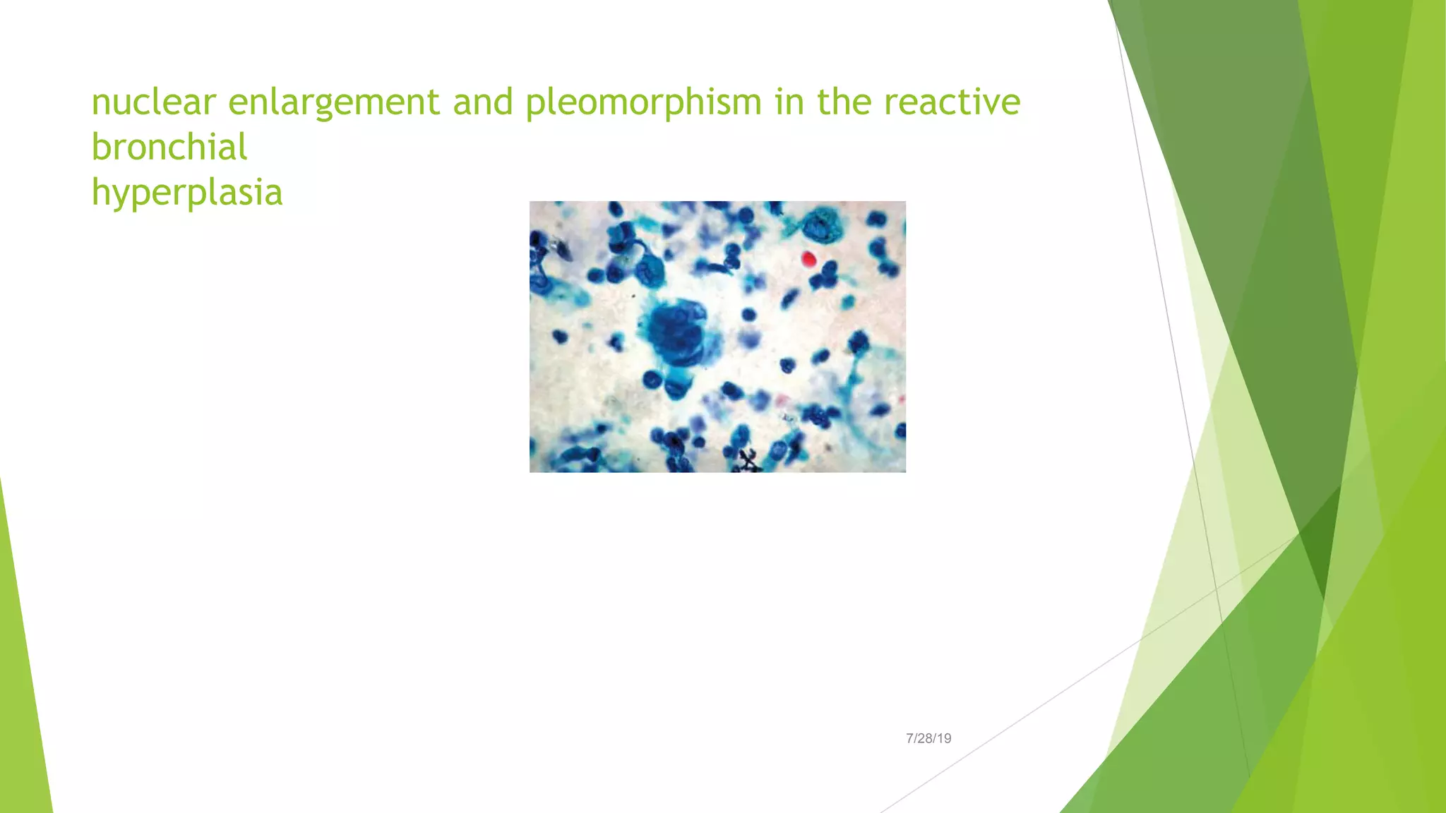 Bronchial washings and brushings | PPT | Lung and Respiratory Health ...