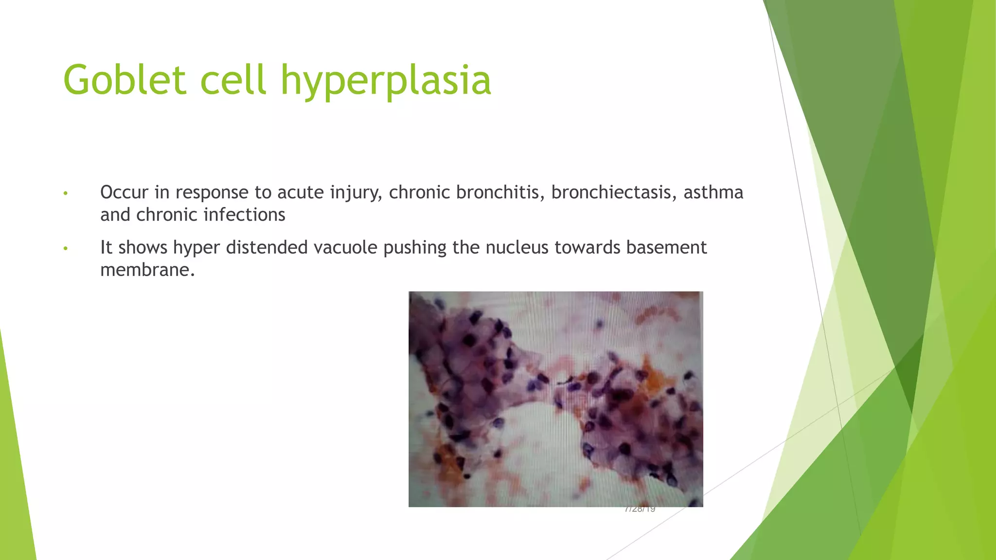 Bronchial washings and brushings | PPT | Lung and Respiratory Health ...