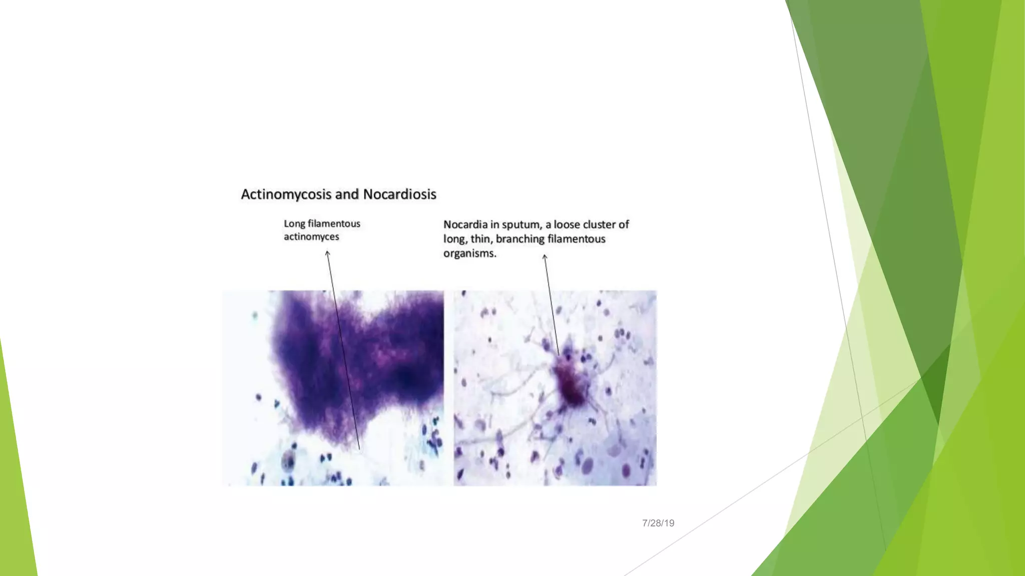 Bronchial washings and brushings | PPT