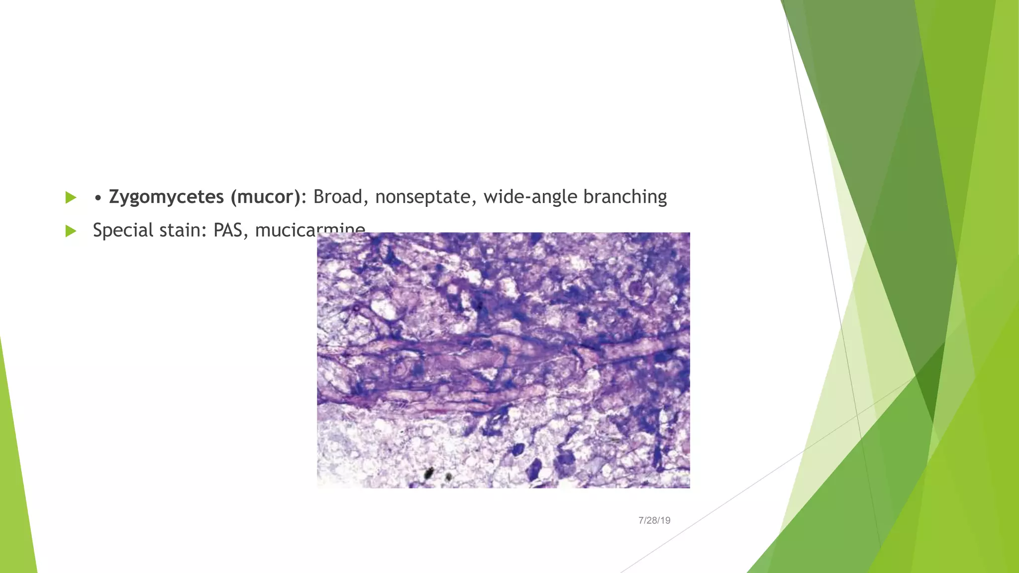 Bronchial washings and brushings | PPT