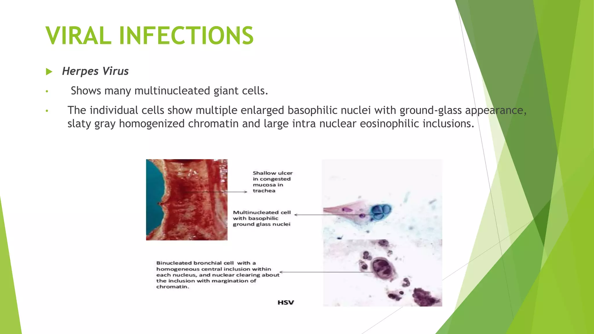 Bronchial washings and brushings | PPT