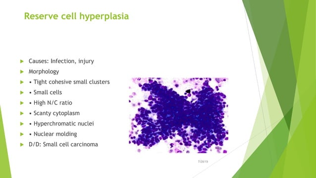 Bronchial washings and brushings | PPT | Lung and Respiratory Health ...