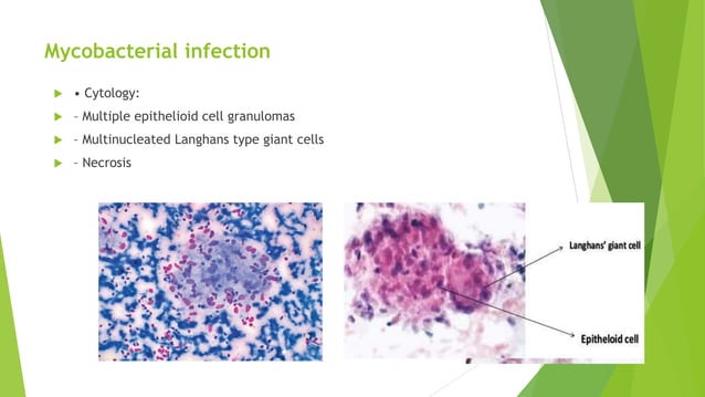 Bronchial washings and brushings | PPT | Lung and Respiratory Health ...