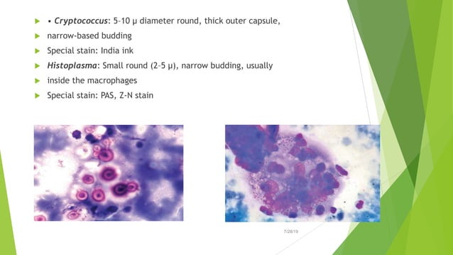 Bronchial washings and brushings | PPT | Lung and Respiratory Health ...
