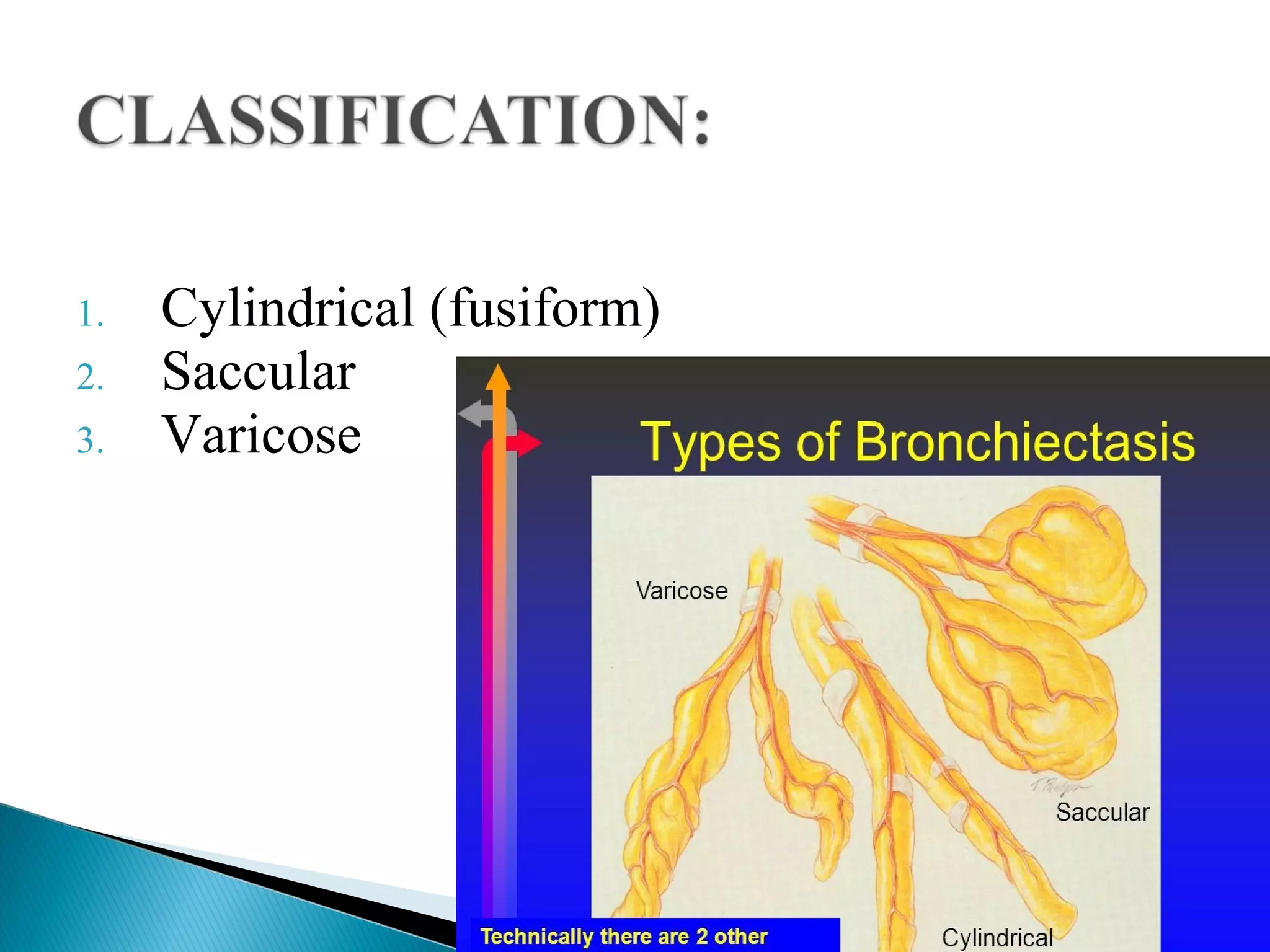 Bronchiectases | PPT