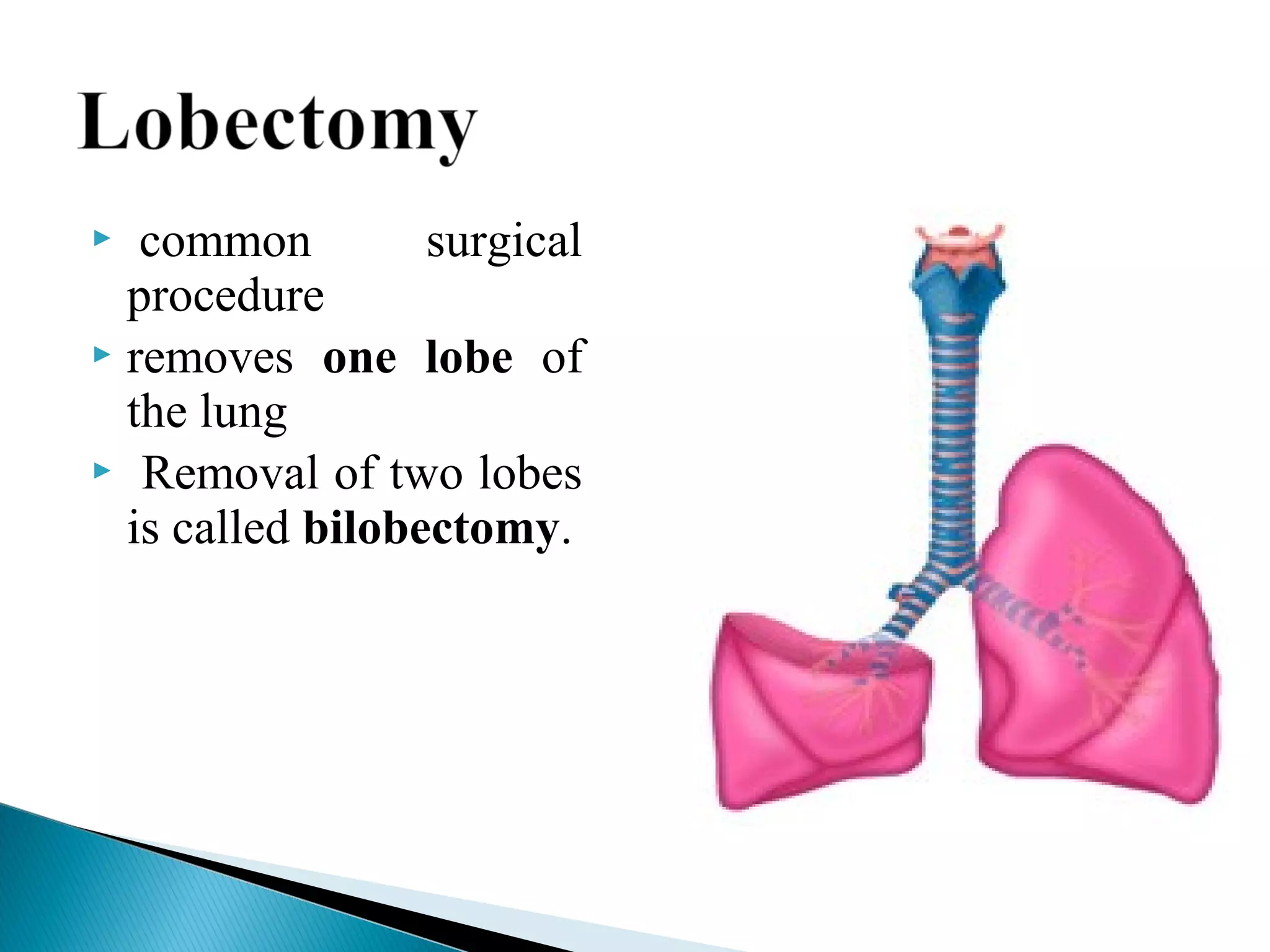 Bronchiectases | PPT