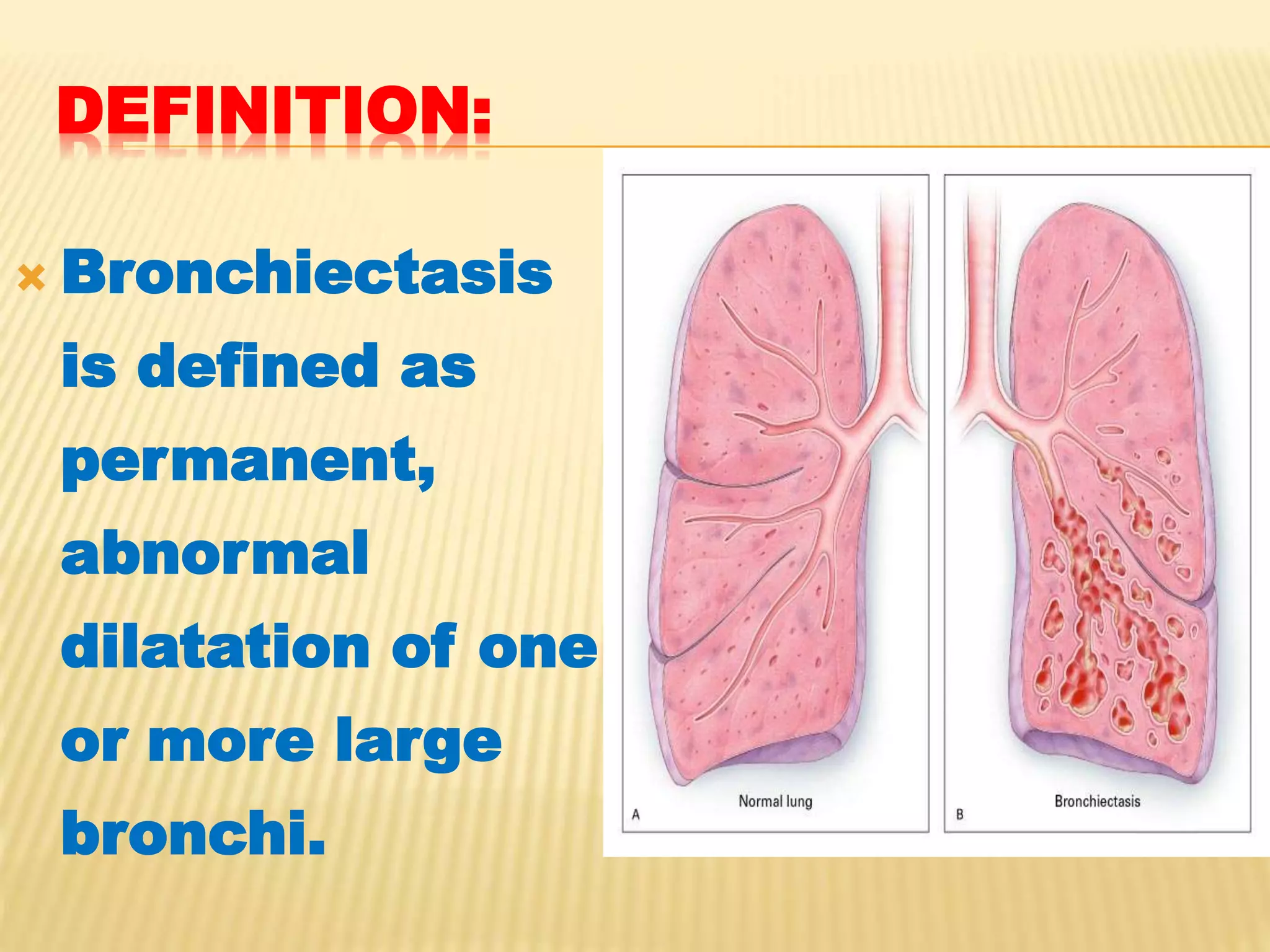 Bronchiectasis | PPTX