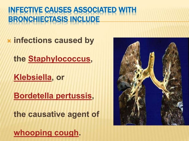 Bronchiectasis | PPTX
