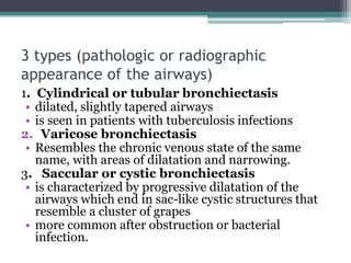 Bronchiectasis | PPT