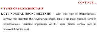 Bronchiectasis | PPT