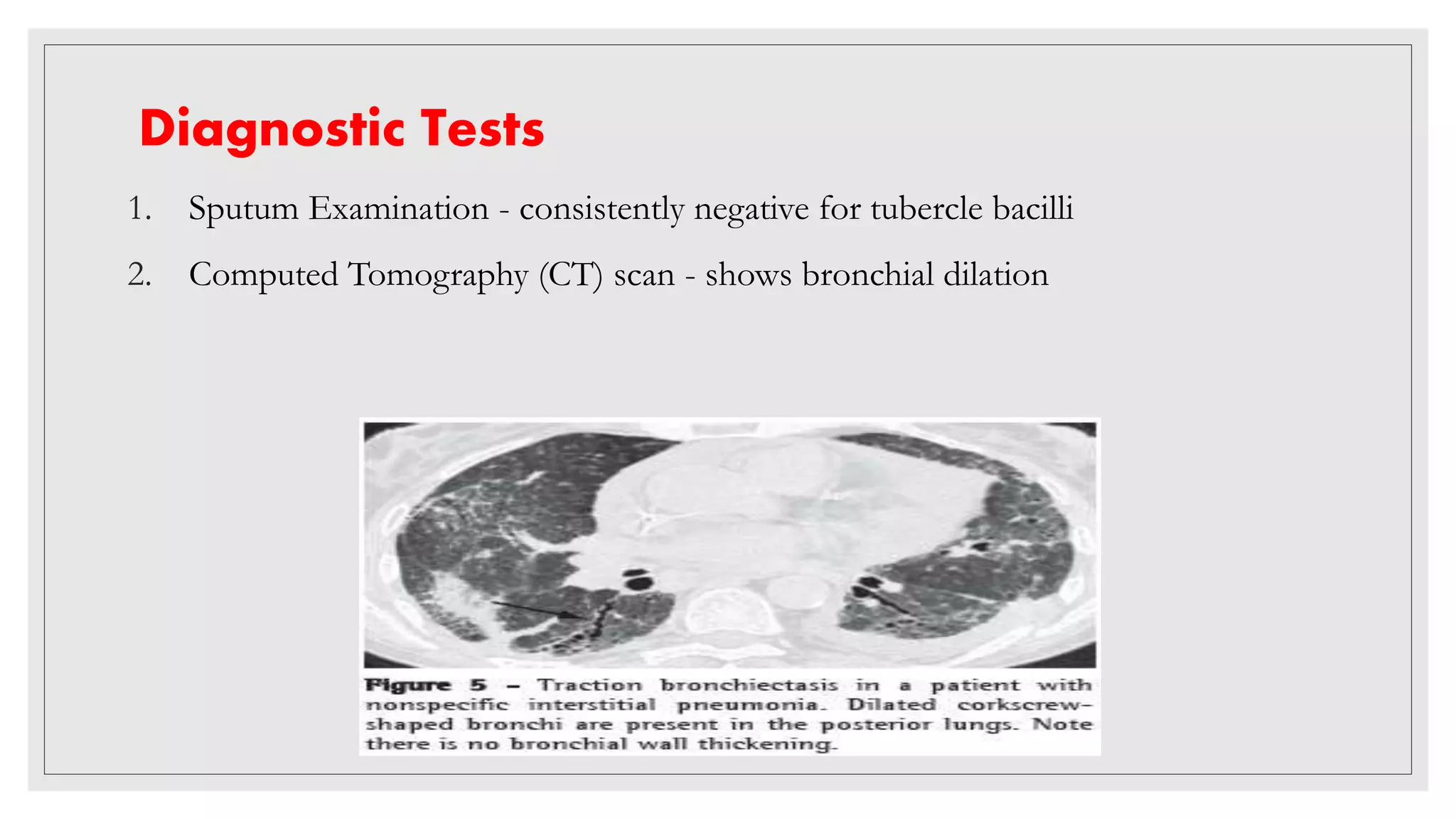 Bronchiectasis, lower respiratory disorders | PPT