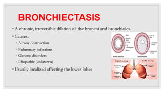 Bronchiectasis, lower respiratory disorders | PPT