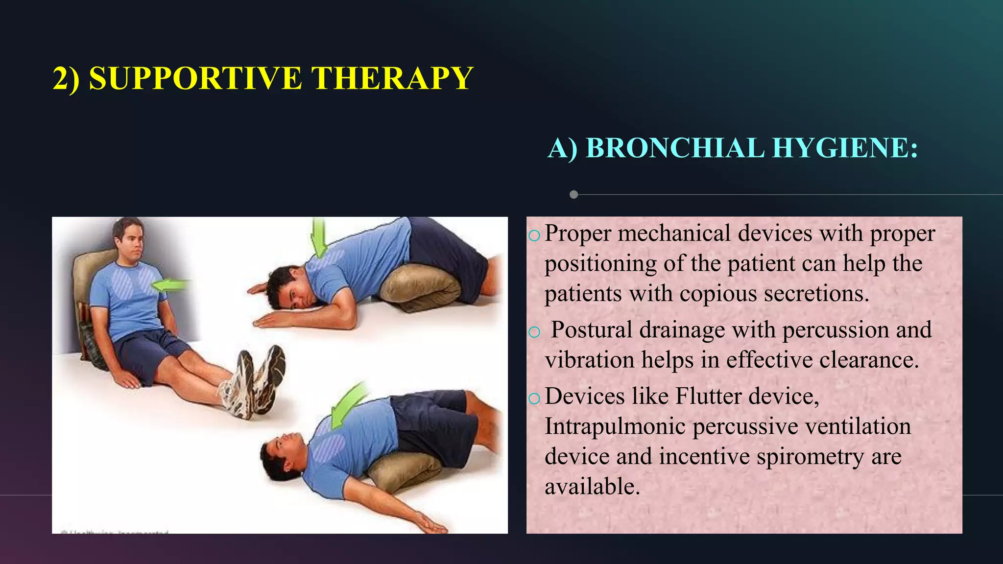 BRONCHIECTASIS | PDF