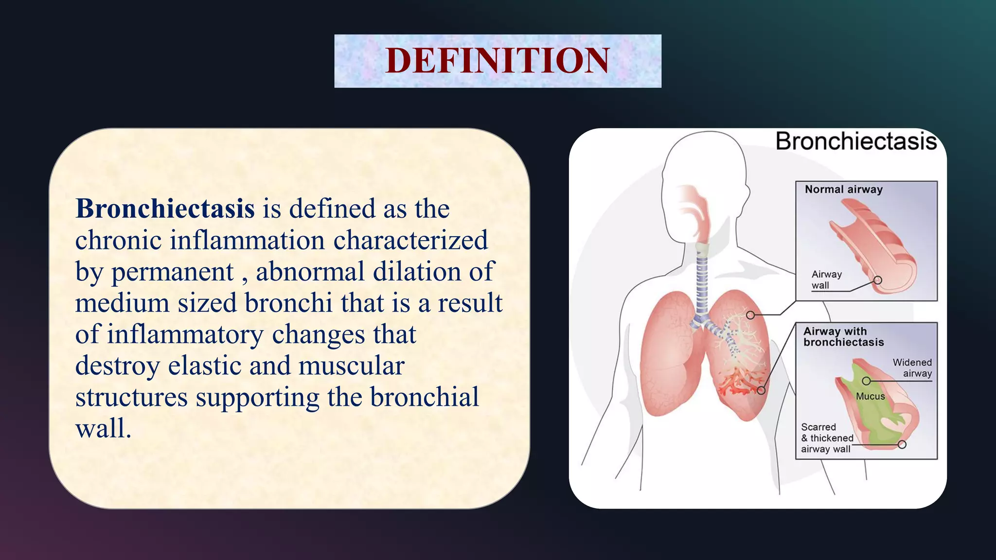BRONCHIECTASIS | PDF