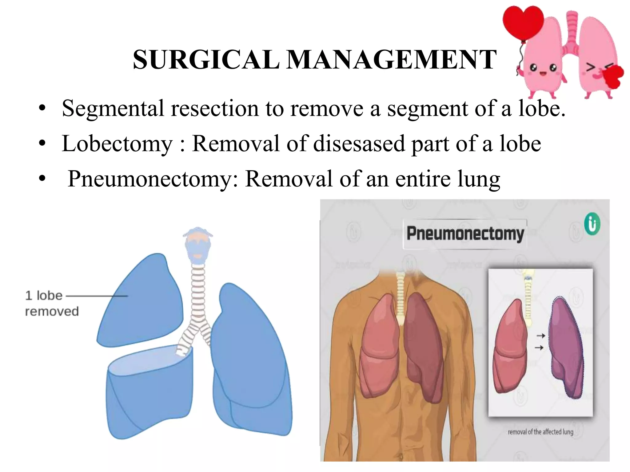 BRONCHIECTASIS.pptx