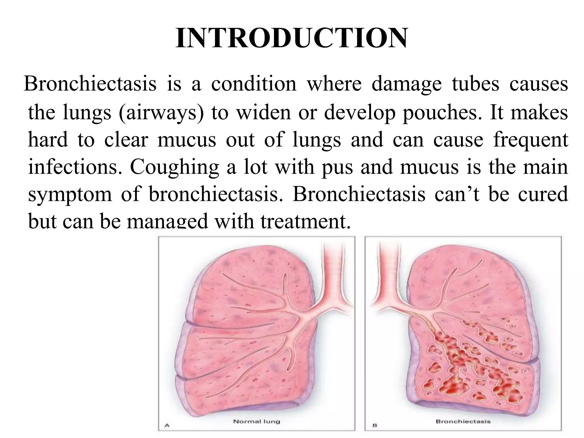 BRONCHIECTASIS.pptx
