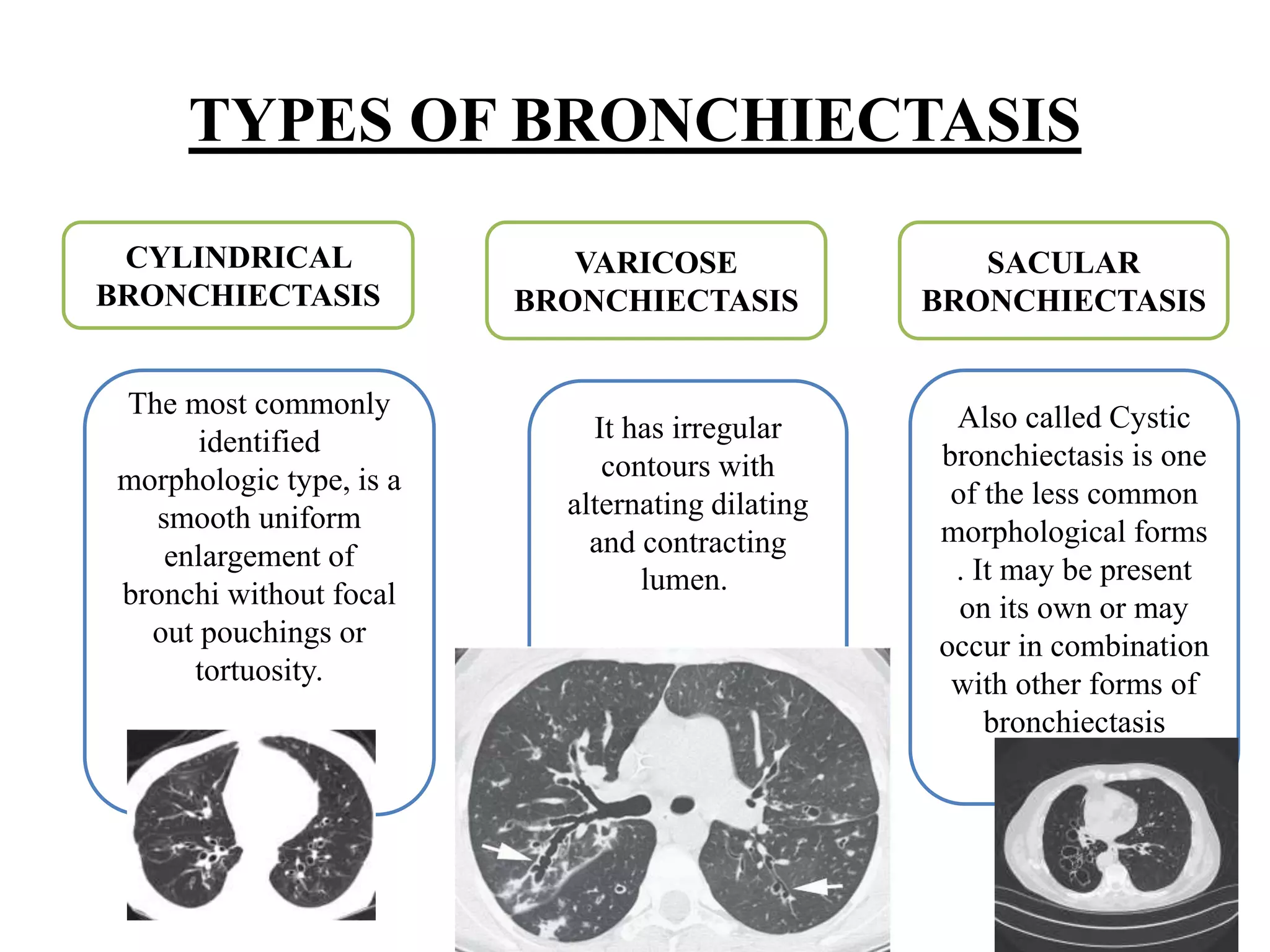 BRONCHIECTASIS.pptx