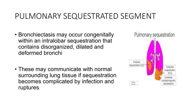 BRONCHIECTASIS.pptx