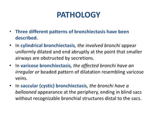 BRONCHIECTASIS.pptx