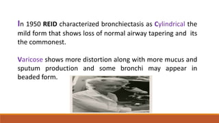 BRONCHIECTASIS approach and treatment by Dr.Amira Tabidi | PPTX