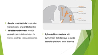 Bronchiectasis- Etiology/Pathophysiology/Management | PPTX