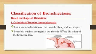 Bronchiectasis.pptx, definition, causes and risk factors, signs and ...